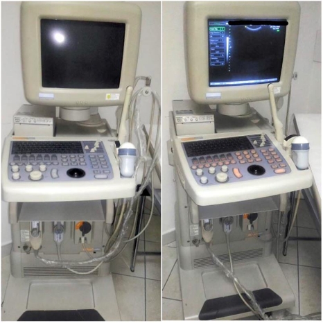 Ecografo Medison sonoace 8000 live prime: attrezzature di lavoro in ...